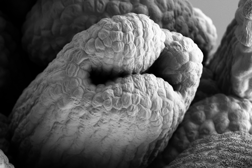 How the adaxial-abaxial axis is regulated during radial symmetry ...