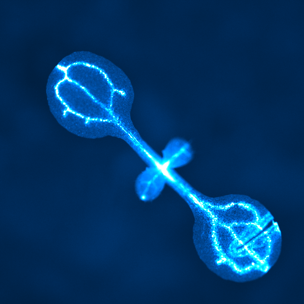 Unravelling a calcium conundrum – the story behind a pioneering ...